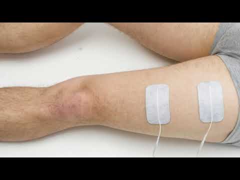 Difference Between Sensory and Motor Nerves