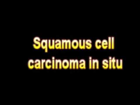 What Is The Definition Of Squamous cell carcinoma in situ Medical School Terminology Dictionary