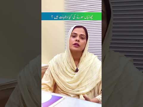 Chaiyaan Q Hoti Hain? - Causes Of Pigmentation - Chaiyaan Honay Ki Wajohaat!