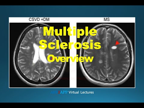 Multiple Sclerosis Overview - Part I