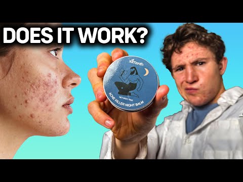 Norse Organics Acne Killer Review - My Results!