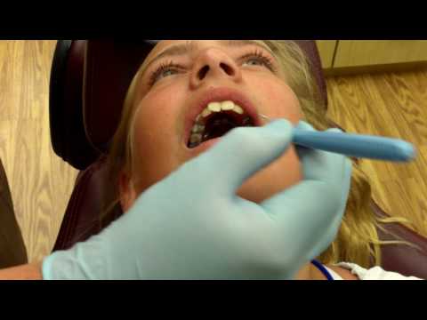 How to: Adjust the Palatal Expander (PE) Key - Banasiak & Nettune Orthodontic Associates