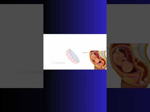 PREECLAMPSIA and EXERCISE! #pregnancy #preeclampsia #cardiovascular #physiology #exercise