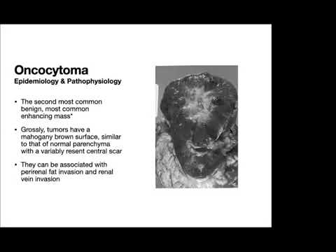 VMMC Urology Campbell Lecture Series: Benign and Malignant Renal Tumors