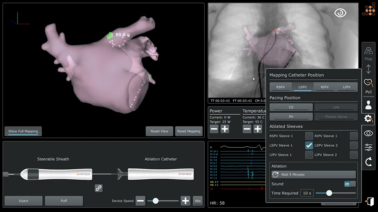 EP Essentials (Pre-Release Edition) | Portable Electrophysiology Training & Device Demo Tool