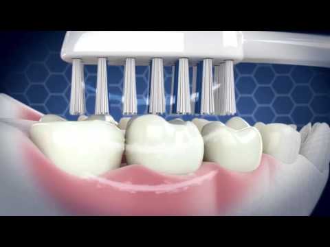 מברשת אולרסוניק Emmi-dent Ultrasonic Toothbrush | מוצרים למטופלים ...
