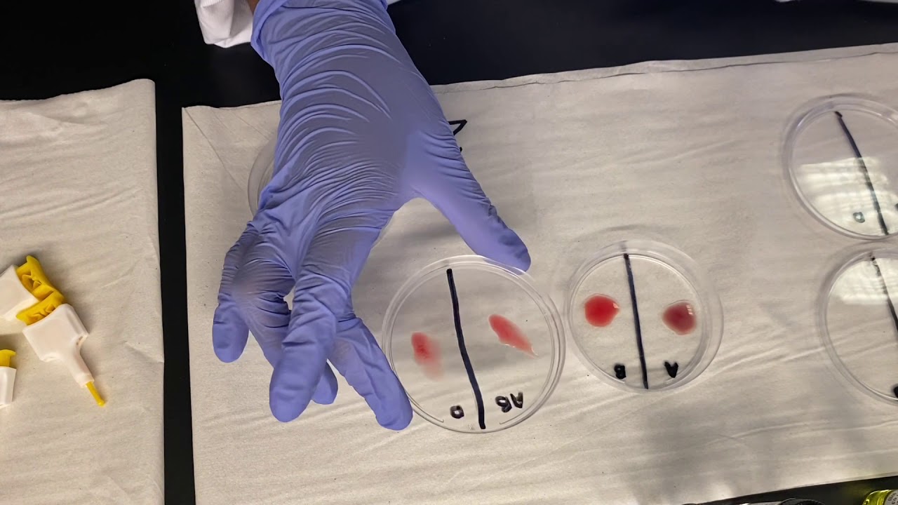 Pathophysiology Lab 1 2021: Haematology