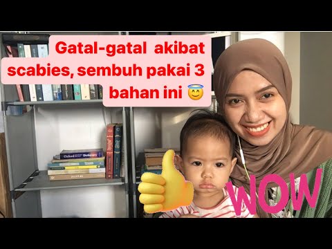 PAKAI 3 BAHAN INI, GATAL SCABIES SEMBUH!!! (SALEP, SERBUK PK, DAUN BIDARA)
