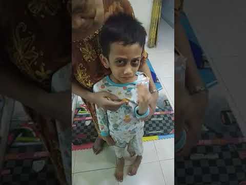 Maafin papa tapi Demi kesehatanmu nak,efek maen hp terus