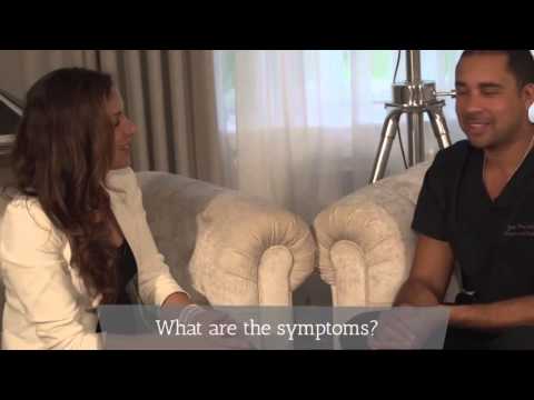 Hand arthritis: what are the main symptoms?