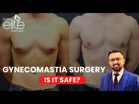 Liposuction & Gynecomastia Surgery in India β Safe or Risky? π₯ | Expert Doctor Reveals All!