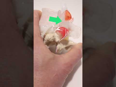 Retrolisthesis