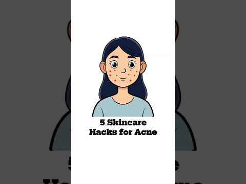 Top 5 Skincare Tips for Acne Prevention and Management According to CKS NICE UK Guidelines!
