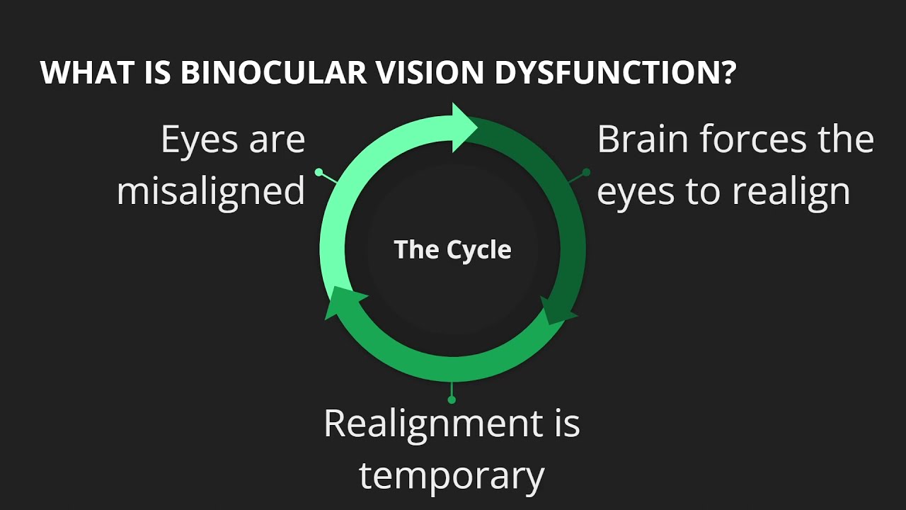 What Is Binocular Vision Dysfunction? | Lakeline Vision Source
