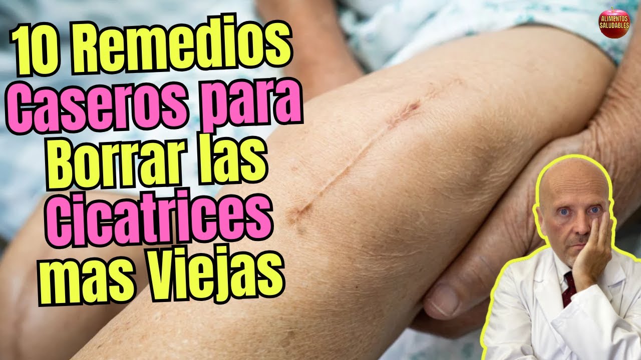 ✨🌿 10 HOME REMEDIES TO ERASE OLD SCARS ON THE SKIN✨🌿