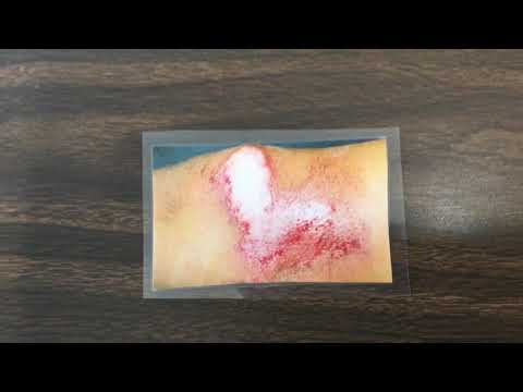 Abrasion Definition