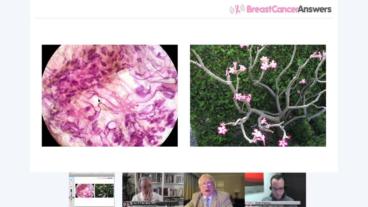 Breast Structure Explained By Dr. László Tabár