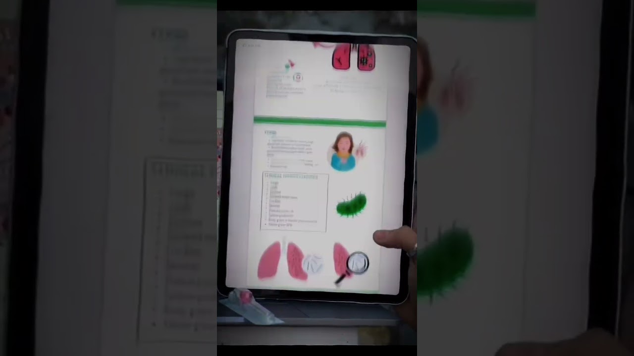 Med surg nursing notes shop on etsy@daisynursingschool #shortvideo #nursing