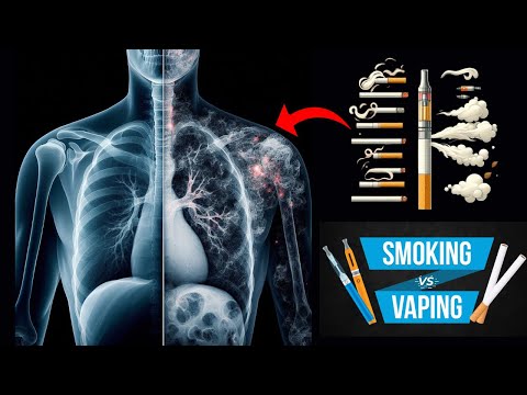 Vaping or Cigarettes Which Is More Harmful | Vaping vs Cigarettes