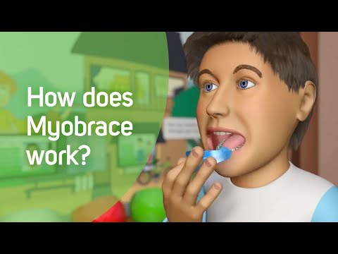 How Does Myobrace Work?