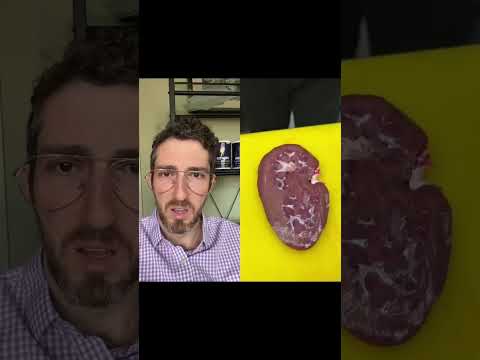 How to Hurt a Nephrologist