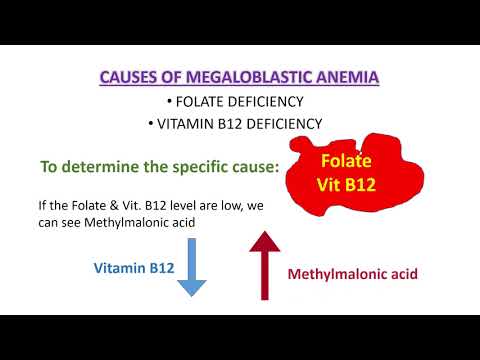 MACROCYTIC ANEMIA