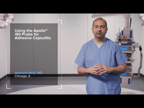 SpeedPearl: Using the ApolloRF® i90 Probe for Adhesive Capsulitis