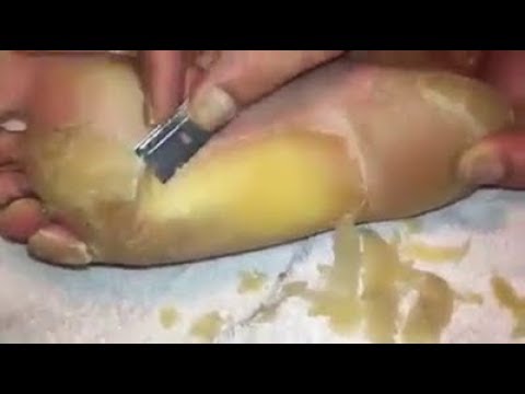 What's the diagnosis?