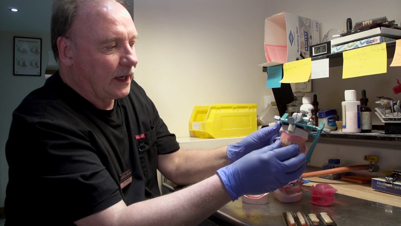 sMiles Better | Denture Making Process
