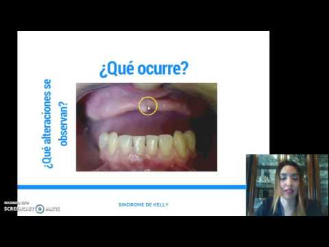 Video Educativo: Síndrome de Kelly – Portafolio digital karem moreno