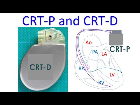 CRT-P and CRT-D