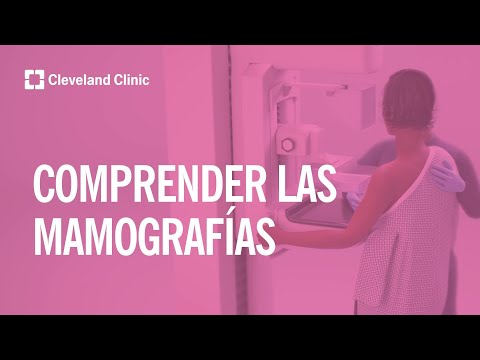 Understanding Mammograms (Spanish)
