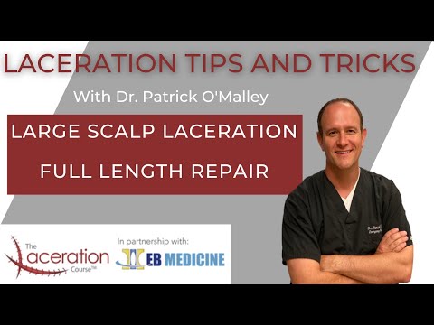 Large scalp laceration