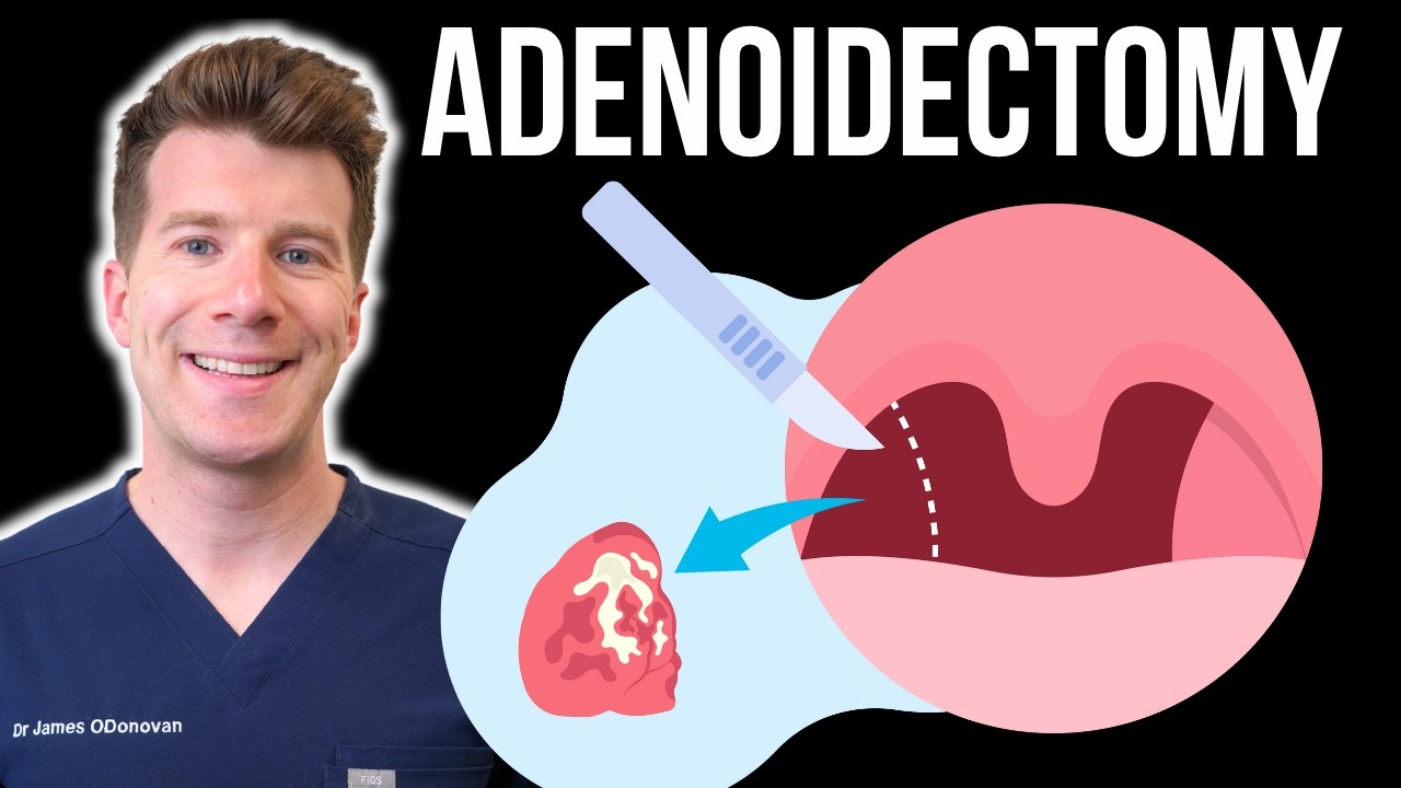 Doctor explains Adenoidectomy | Adenoid removal surgery
