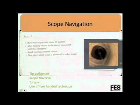 How was FES Validated? Melina Vassiliou, M.D.