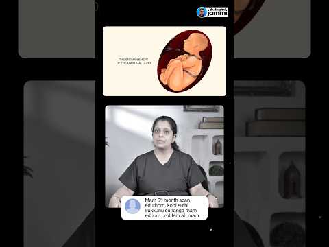 Cord around the neck: Should you be worried? #shorts #pregnancy