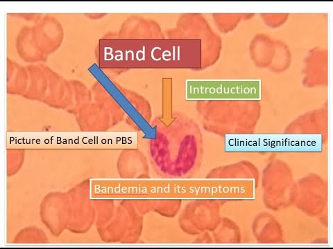 Band cell or Stab cell on PBS, introduction and its clinical significance