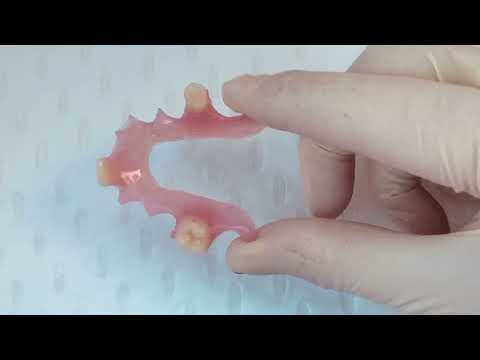 Flexible Dentures | ThermoSens | No Metal Clasps
