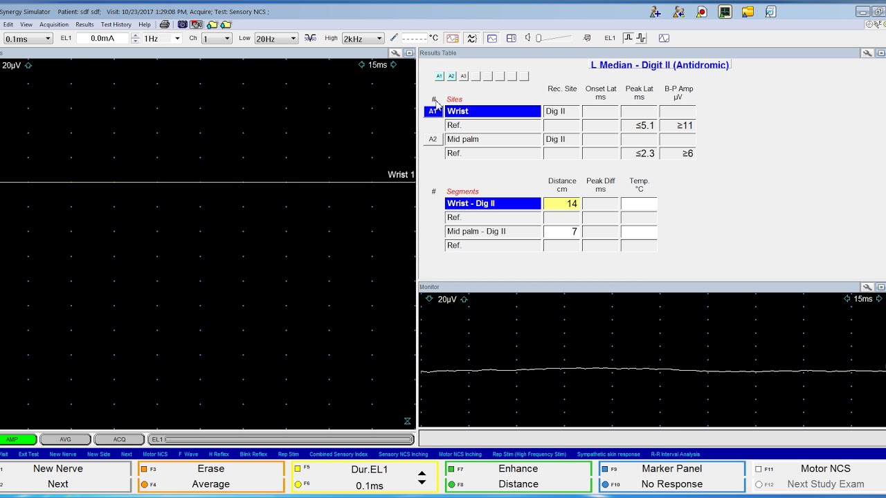How to modify normal values EMG