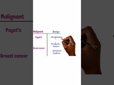 Benign breast disease #medicaleducation #health #aktexam