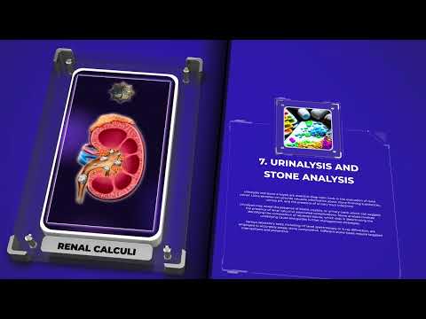 Renal calculi
