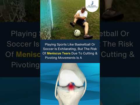 Get Back in the Game Faster with Knee Arthroscopy Surgery for Meniscus Tears from Sports