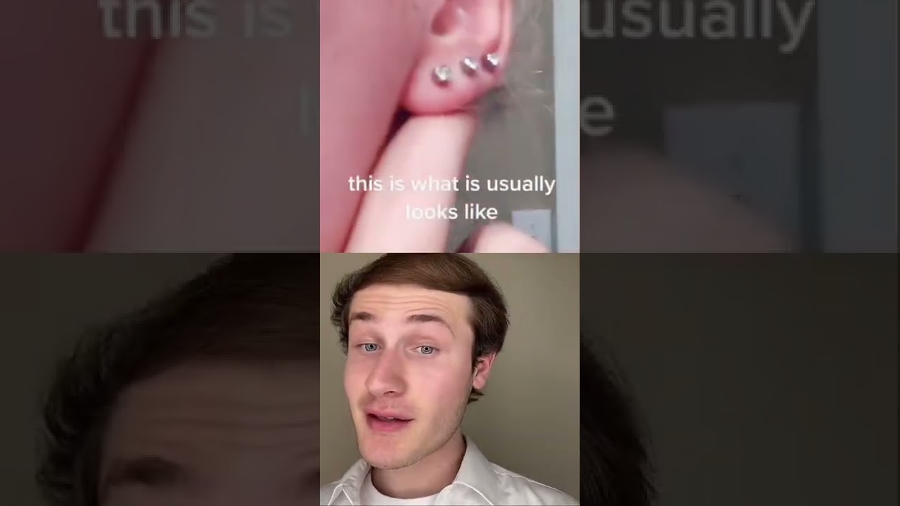 What is This Hardened Lump On The Earlobe?? #shorts