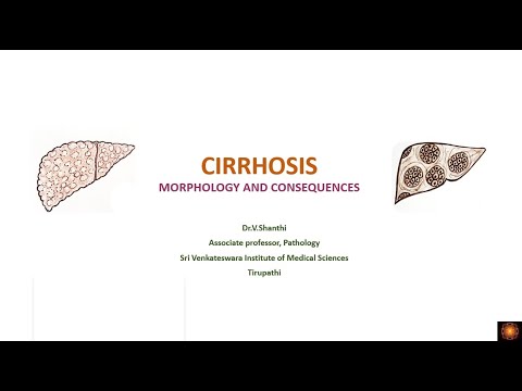 Cirrhosis - morphology and consequences