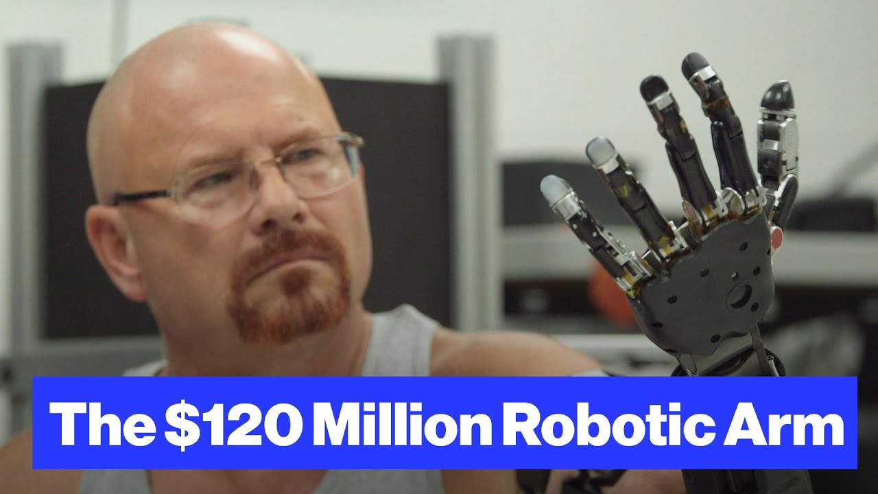 The Robot-Arm Prosthetic Controlled by Thought