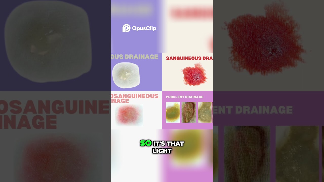 Understanding Wound Drainage  Types and Healing Process