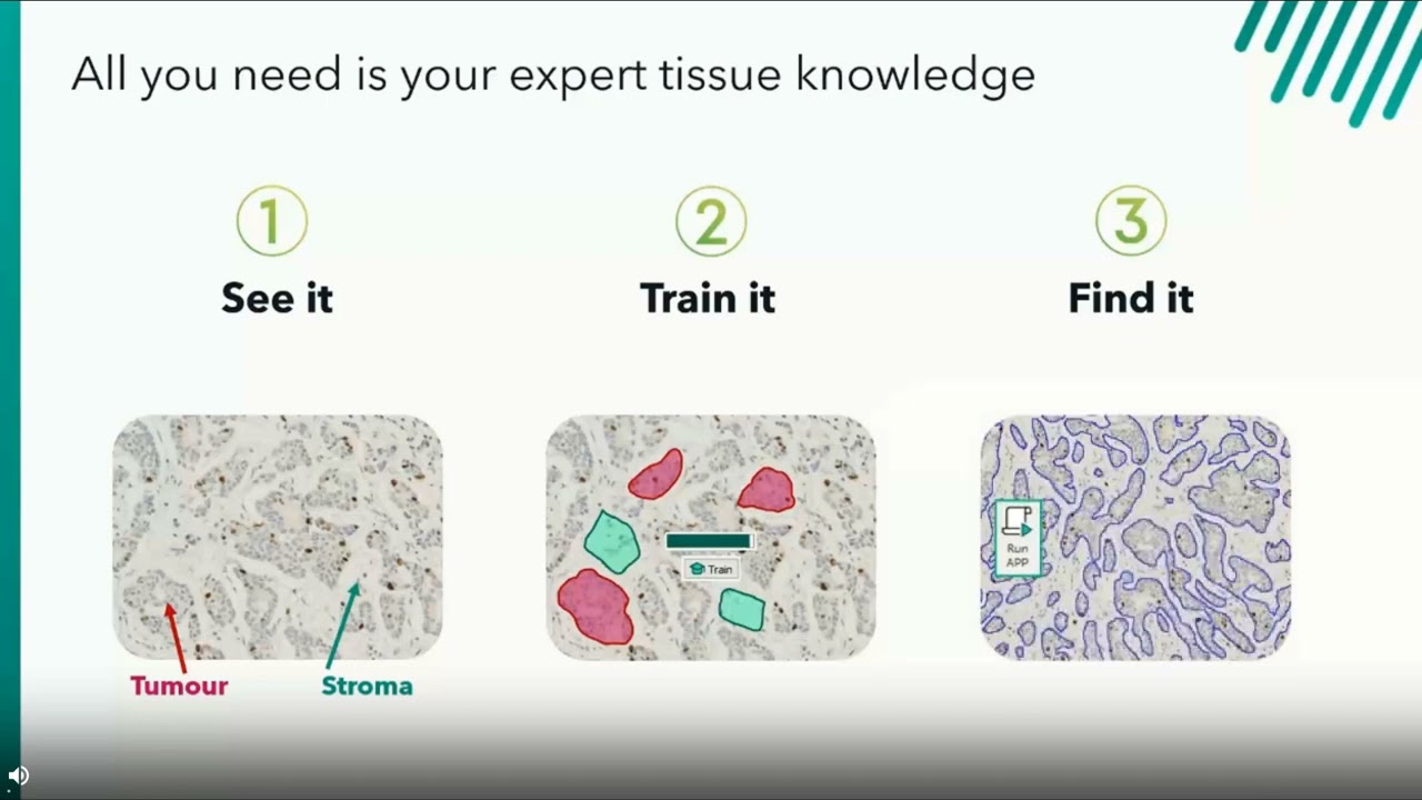 Oncotopix Discovery  deep learning as a standard analysis method for digital pathology images