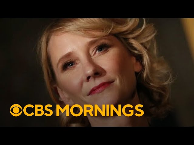 Anne Heche autopsy report delves deeper into circumstances surrounding ...