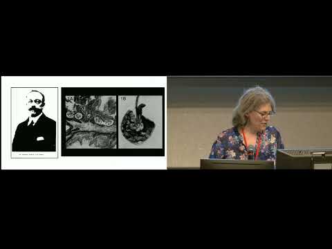 H. pylori: A Historical Perspective on Its Association with Cancer, with Dr. Julie Parsonnet