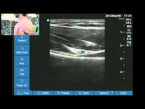 Locating the axillary nerve